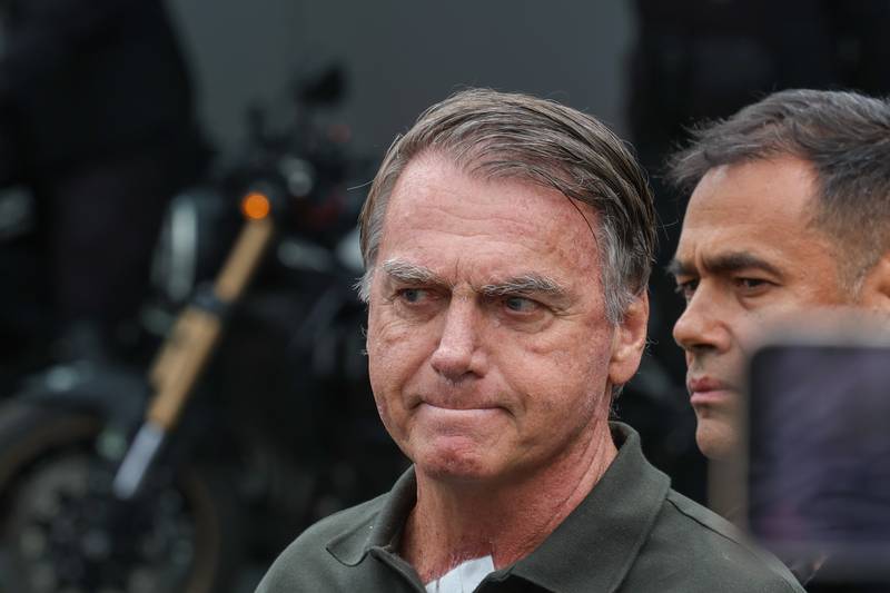 Bolsonaro fará endoscopia para investigar refluxo e soluços ...